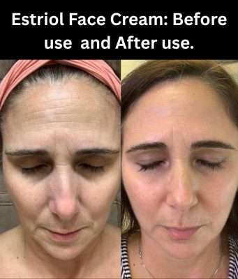 Estriol Face Cream: Everything You Need to Know About This Anti-Aging ...