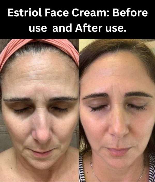 Estriol Face Cream: Everything You Need to Know About This Anti-Aging ...